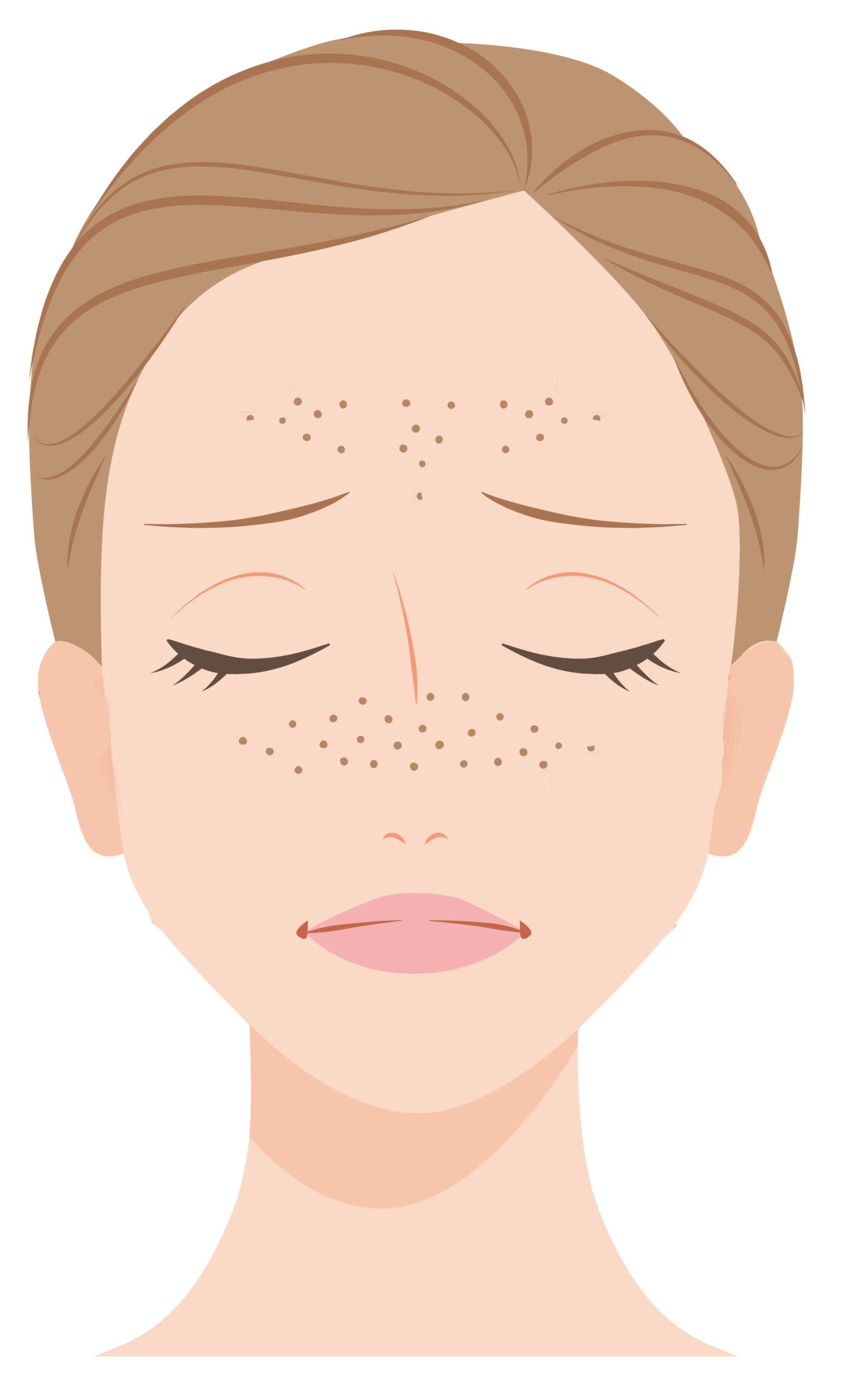 The Skinfirm - PMU Sproetjes